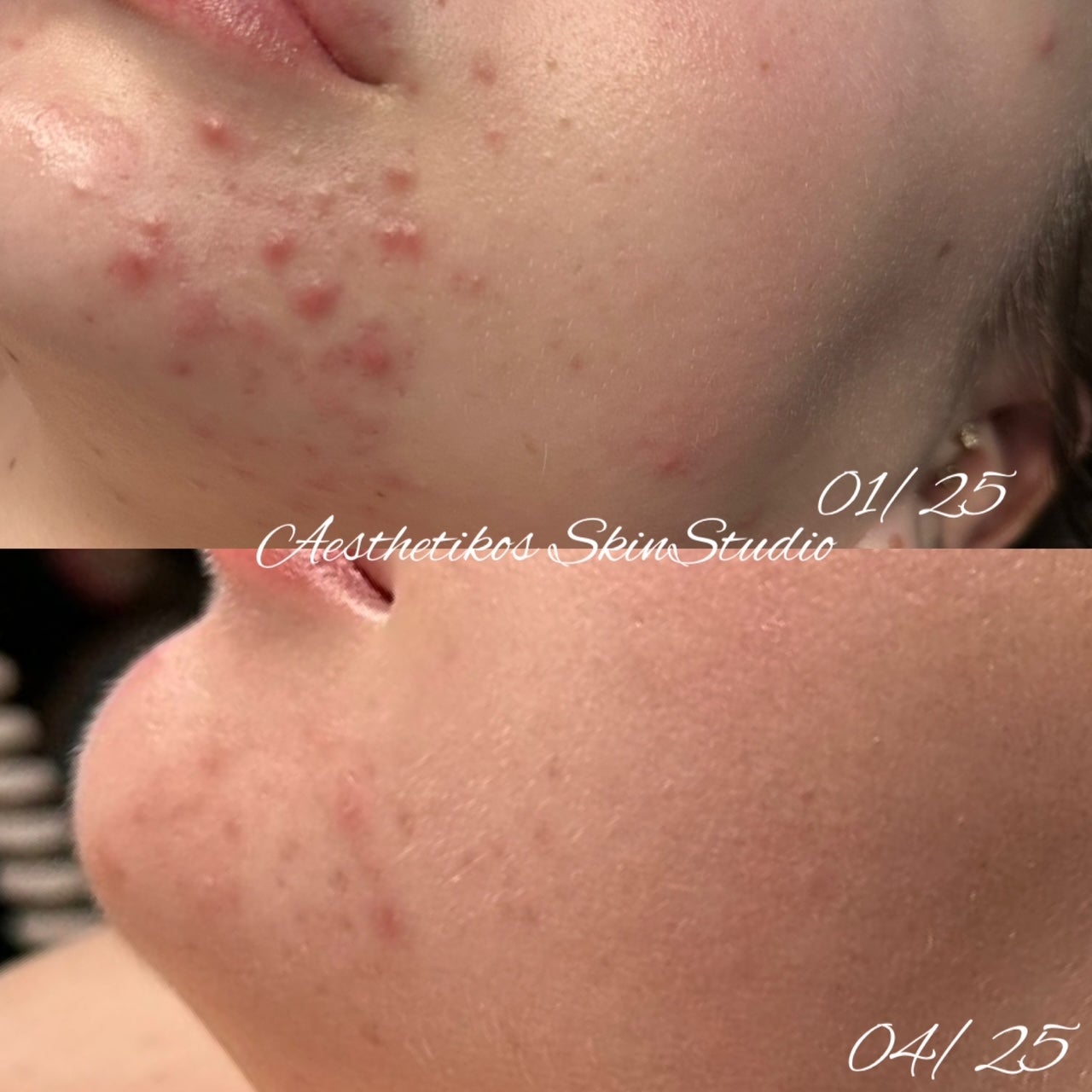Skin Packages | Aesthetikos Skin Studio